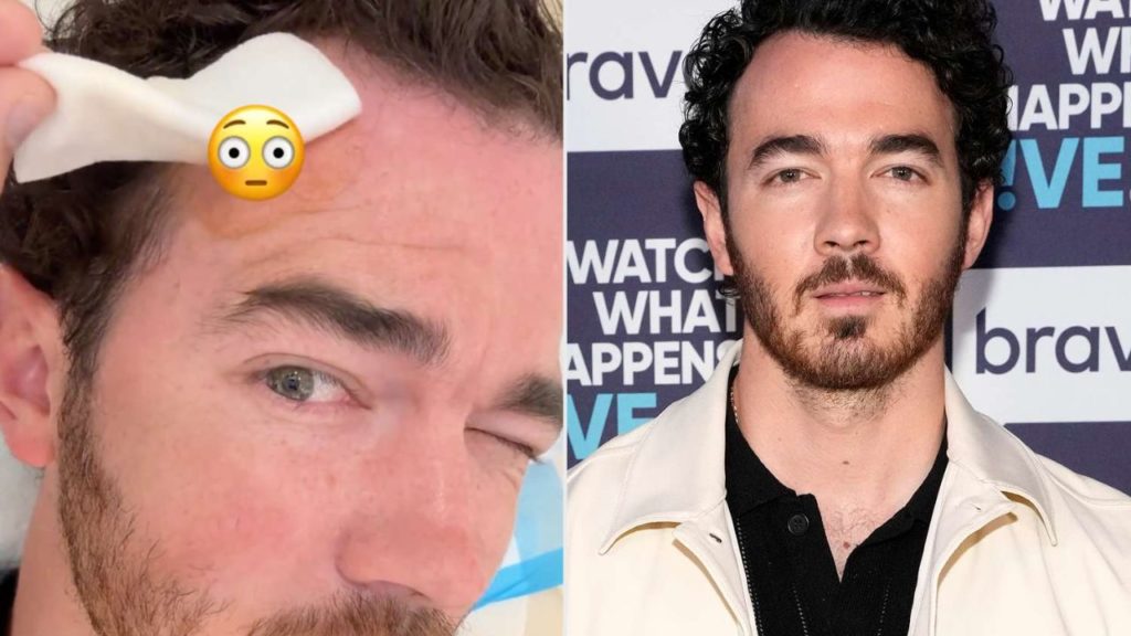 Kevin Jonas se somete a una cirugía para extirpar el cáncer de piel ...